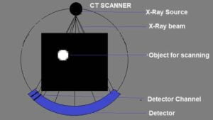 Modern CT Scan Complete 50 years - Computer Technology
