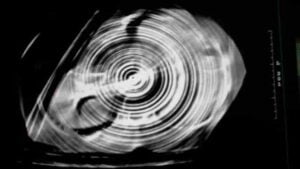 Modern CT Scan Complete 50 years - Computer Technology